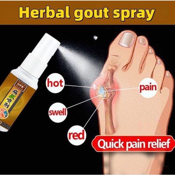 [Original] Gout spray Ubat gout Ubat joint pain Rapid swelling Pain ...