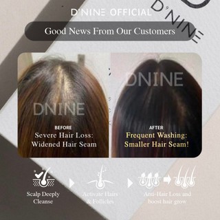 D'NINE™ Shampoo made in Korea effective for Anti Hair Loss Shampoo ...