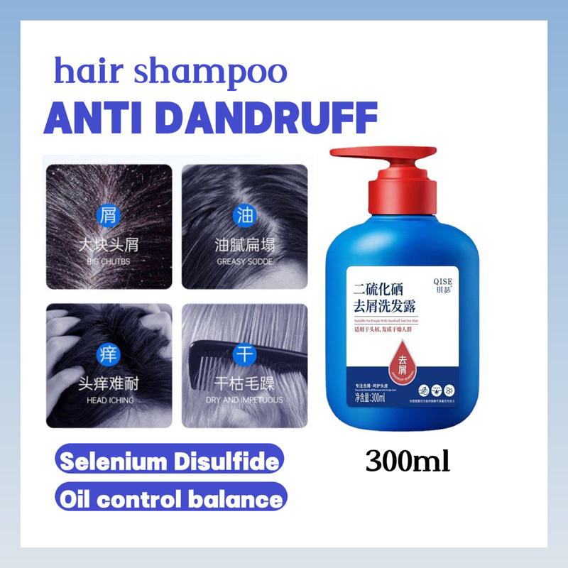 Anti-Dandruff Syampoo Kelemumur Gatal Kepala 300ml Scalp Itchy scalp ...