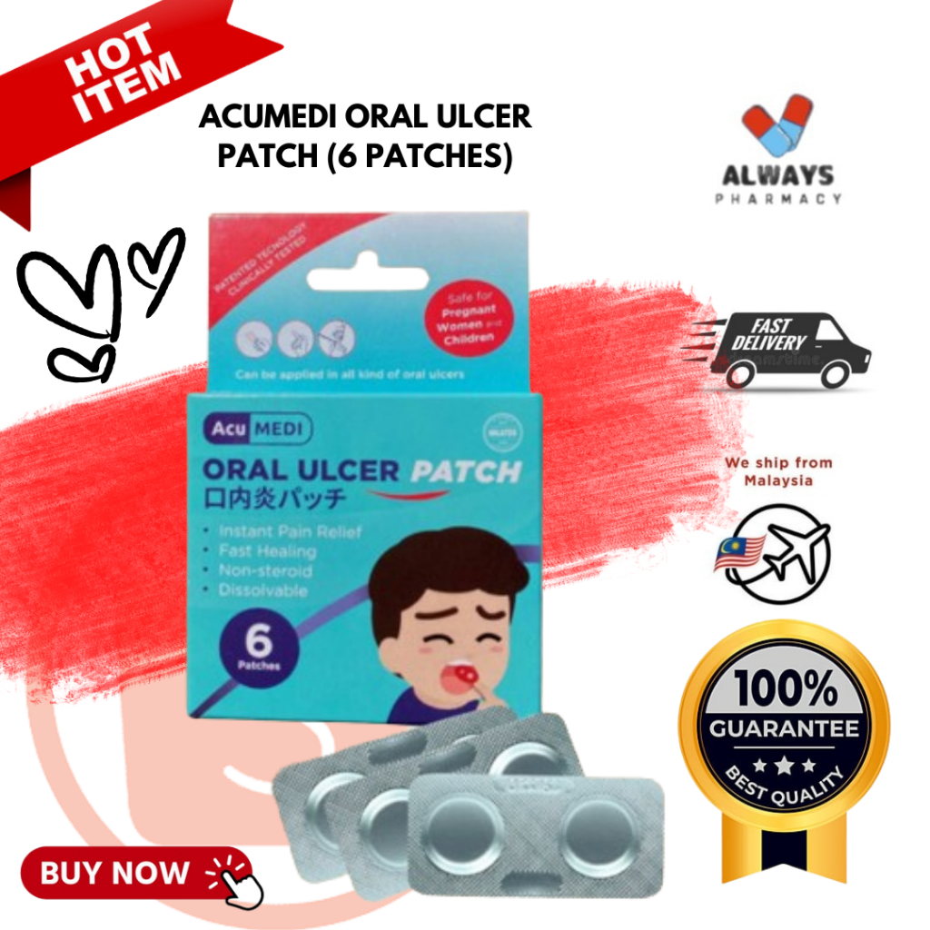 1 BOX | ACUMEDI ORAL ULCER PATCH (6 PATCHES PER BOX) | ULCER DEWASA DAN ...