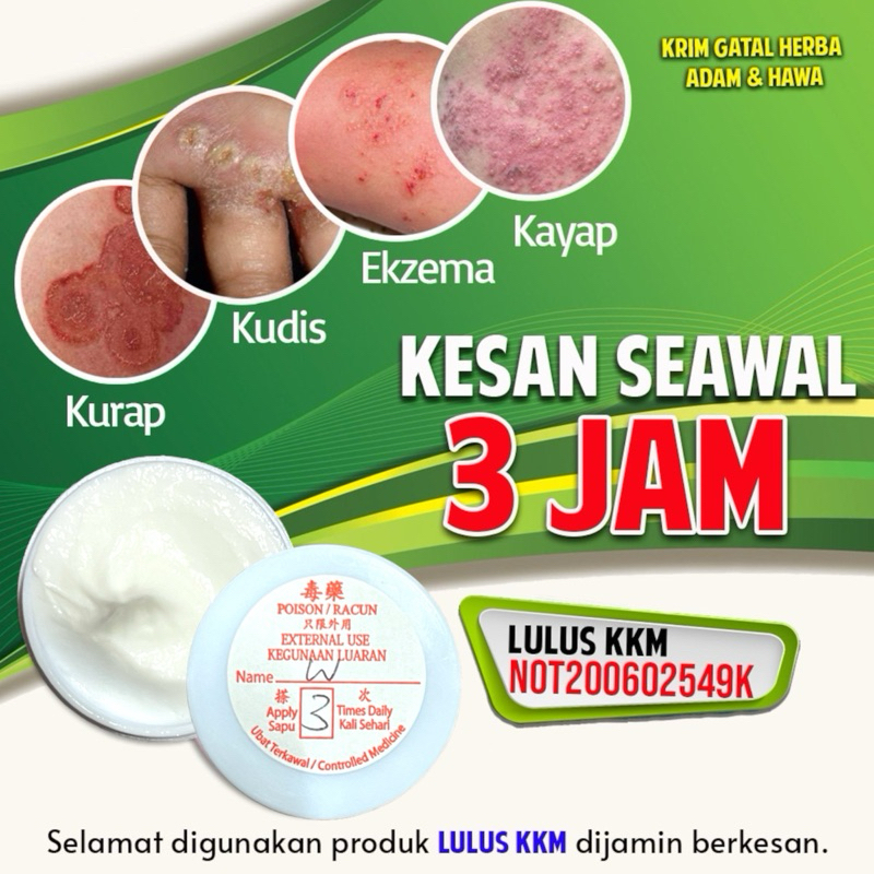 KRIM MUTIARA UNTUK RAWAT KULIT GATAL KURAP ECZEMA [ALEX] | Shopee Malaysia