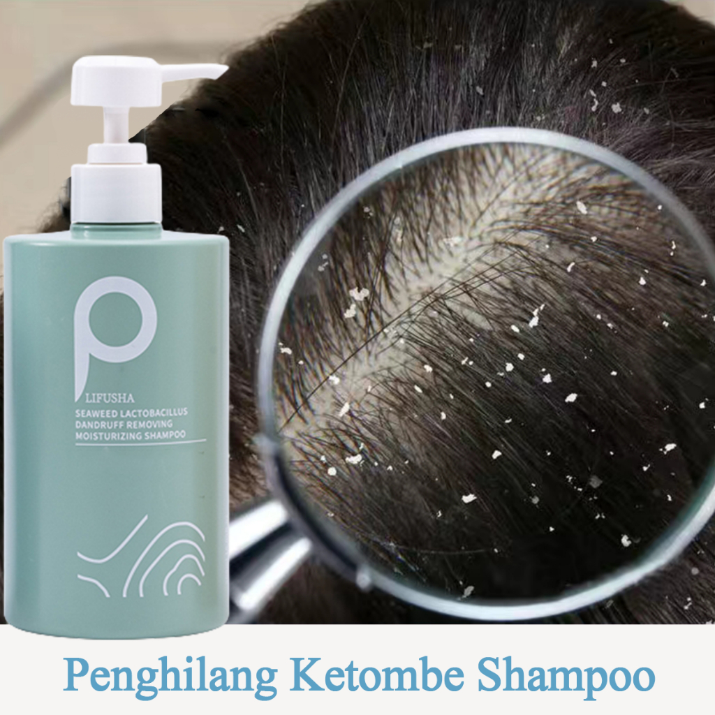 Syampu Kelemumur kepala psoriasis anti dandruff shampoo Kelemumur ...