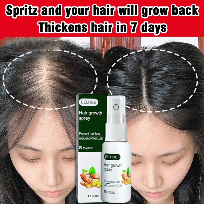Restore hairstyle Nourishing Hair Root Hair growth spray Anti hair Loss ...