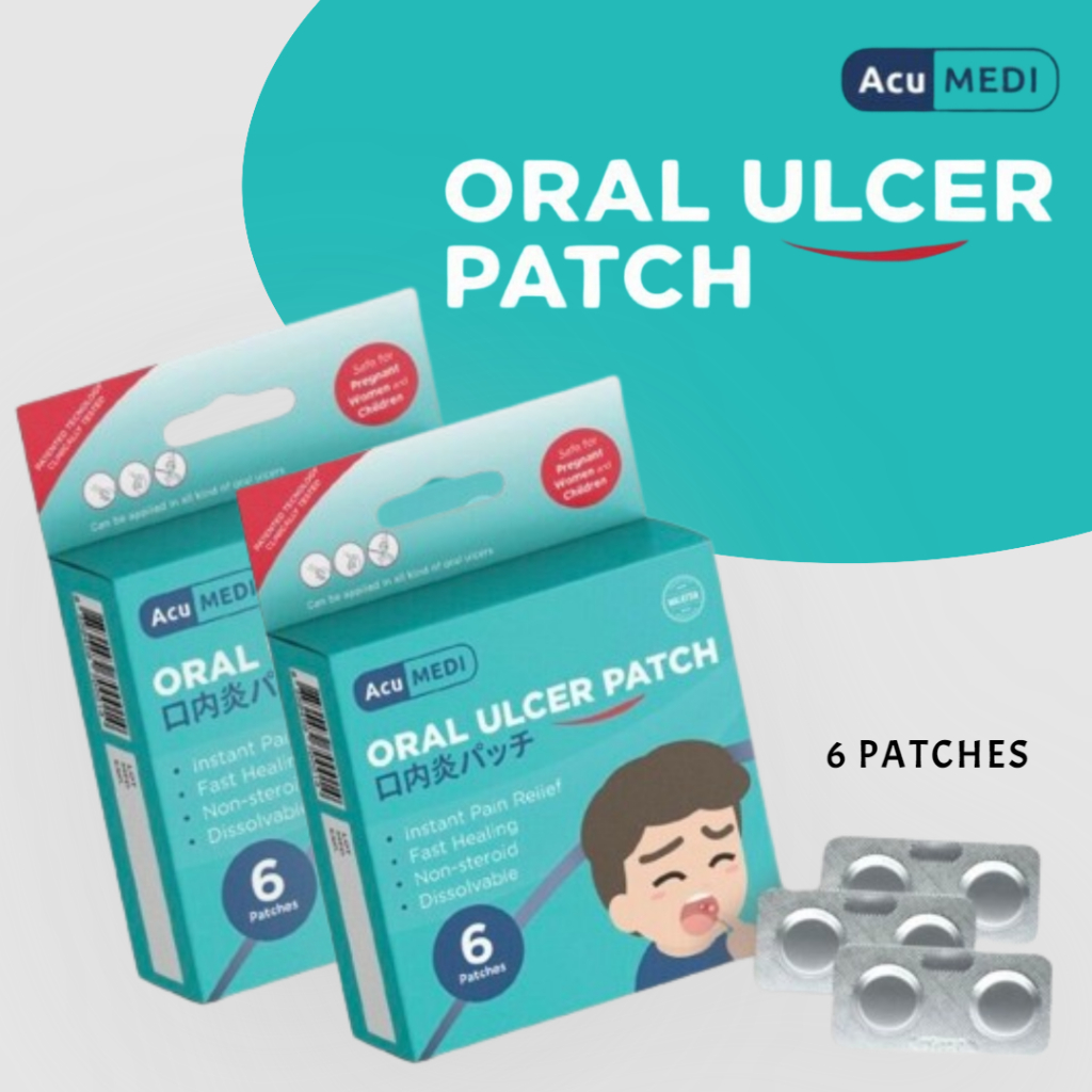 ACUMEDI Pelekat luka Sakit Gusi Lidah mulut Patches for oral gums tongue ulcer | Shopee Malaysia