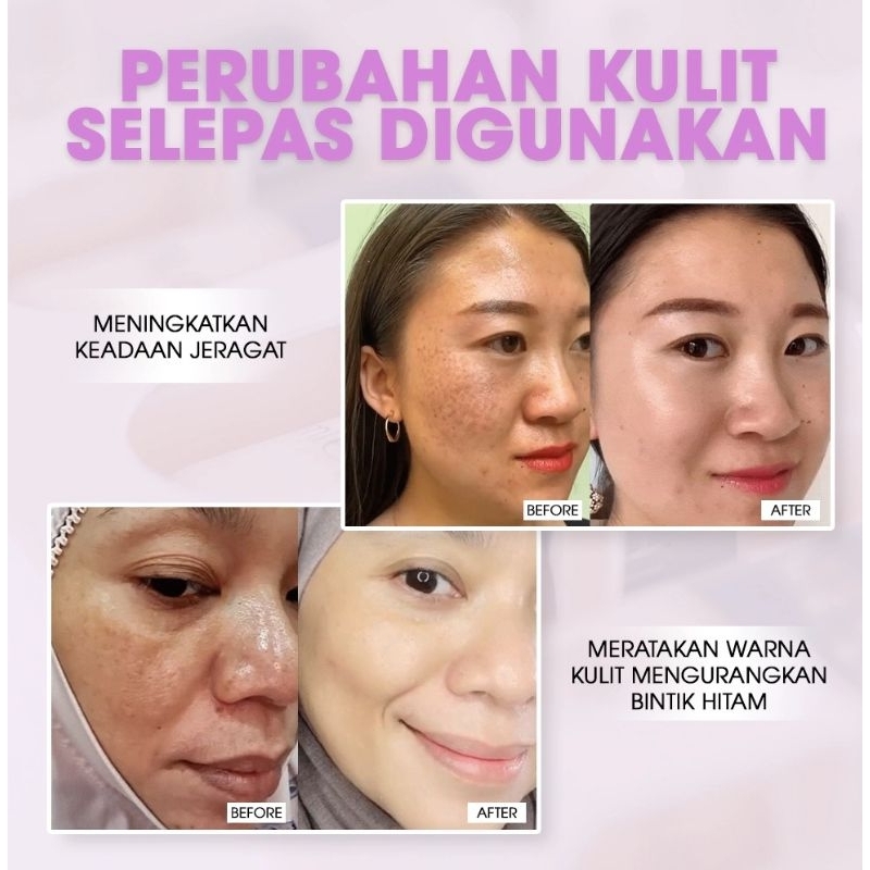 💯 ORIGINAL SEYOUL MESO WHITE STEM CELL SKIN WHITENING | Shopee Malaysia