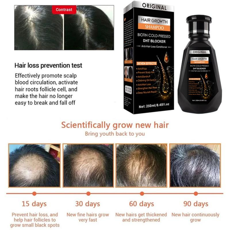 Hair Growth Essence Hair Shampoo Anti-Hair Loss Preventing Hair Loss ...