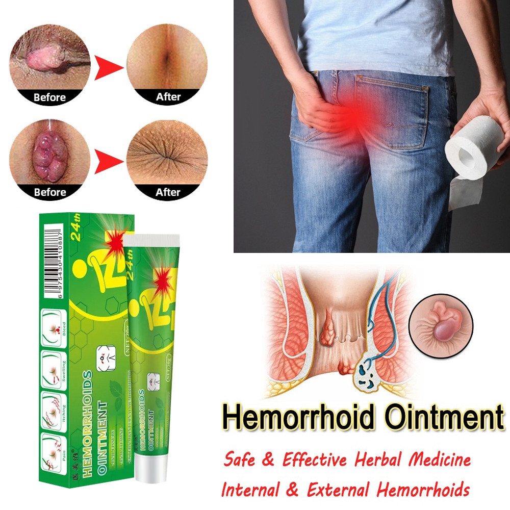 Herbal Hemorrhoid Cream Ointment Krim buasir Ubat buasir 20g Effective Relieve Anal Pain Swell ...