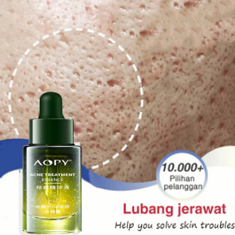 Acne serum Acne pit serum Acne scar serum 30ml Acne relieves acne scars ...