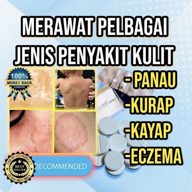 Ubat Panau,Kurap,Kayap dan Eczema (Dijamin Berkesan) | Shopee Malaysia