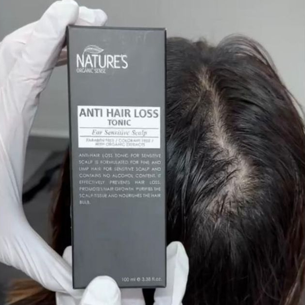 Nature's Organic Sense - Anti Hair Loss Tonic (100ml) | Shopee Malaysia
