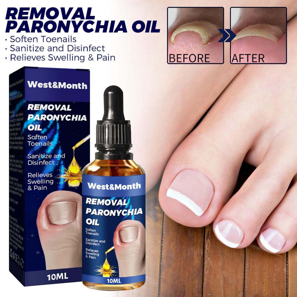 Anti Paronychia Relief Oil Ingrown Toenail Drops Soften Repair Essence ...