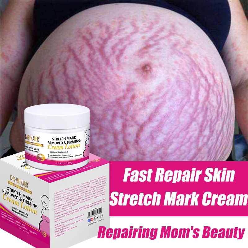 Stretch Mark Cream Pregnancy Cream Maternity Cream 150g Remove Stretch ...