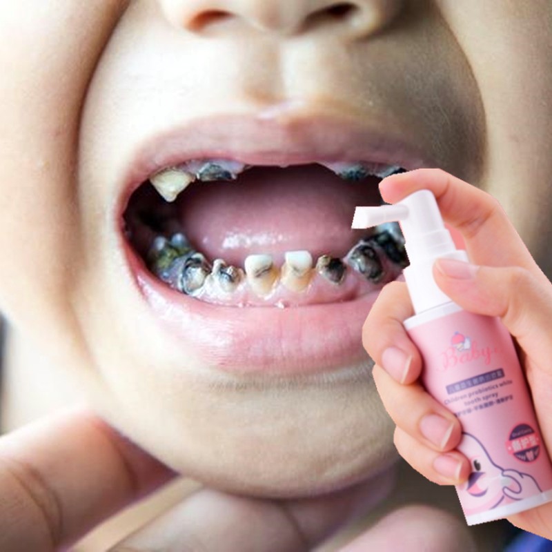 Semburan Gigi Kanak Kanak Bayi Probiotics Mulut Pembersihan Mulut Tooth ...