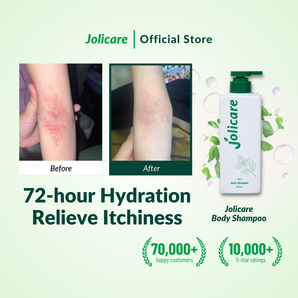 Jolicare Body Shampoo - Herbal Repair For Dry Itchy Sensitive Skin ...