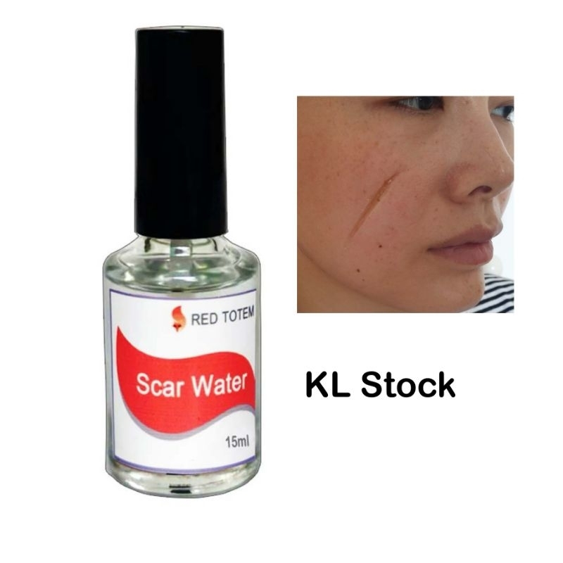 Scar Water 15ml Collodion Scarring Liquid Special Effects Halloween ...