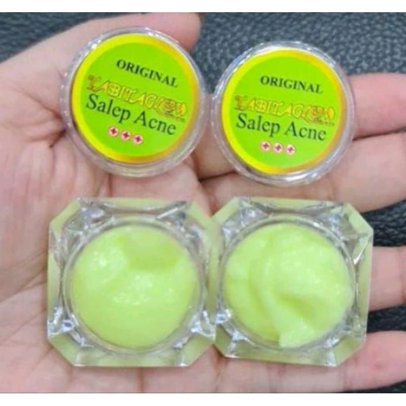 salep Jerawat/Acne TabitaGlow | Shopee Malaysia