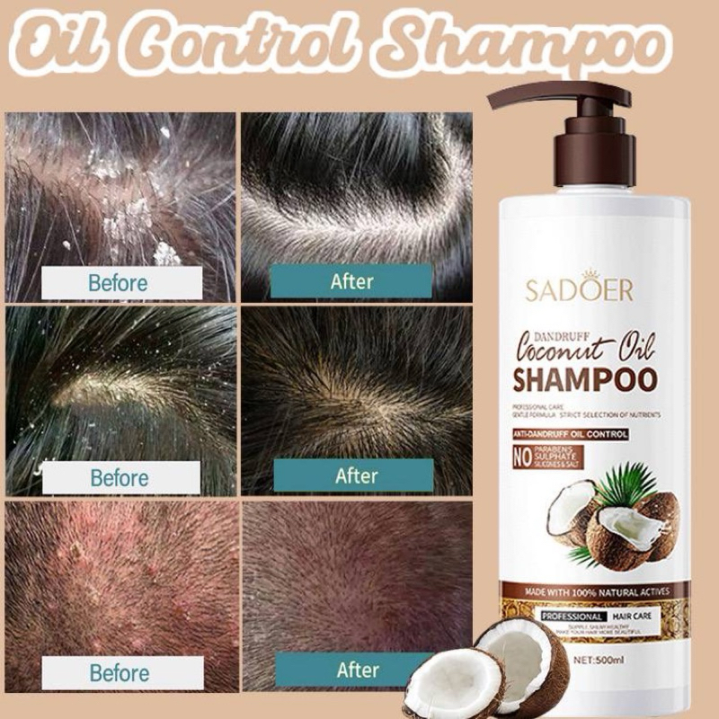 SADOER SHAMPOO ANTI DANDRUFF Shampoo minyak kelapa anti kelemumur Menghilangkan kelemumur ...
