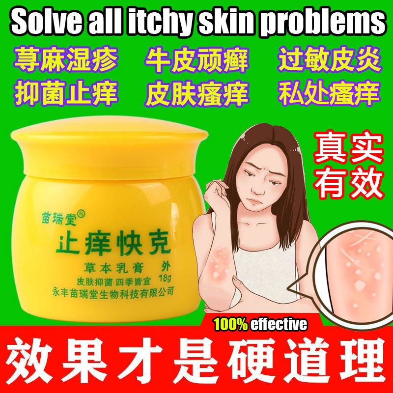 【ready stock】止痒快克18g Eczema cream 急慢性荨麻疹膏风团止痒膏 ubat gatal kulit过敏瘙痒皮肤病 ...