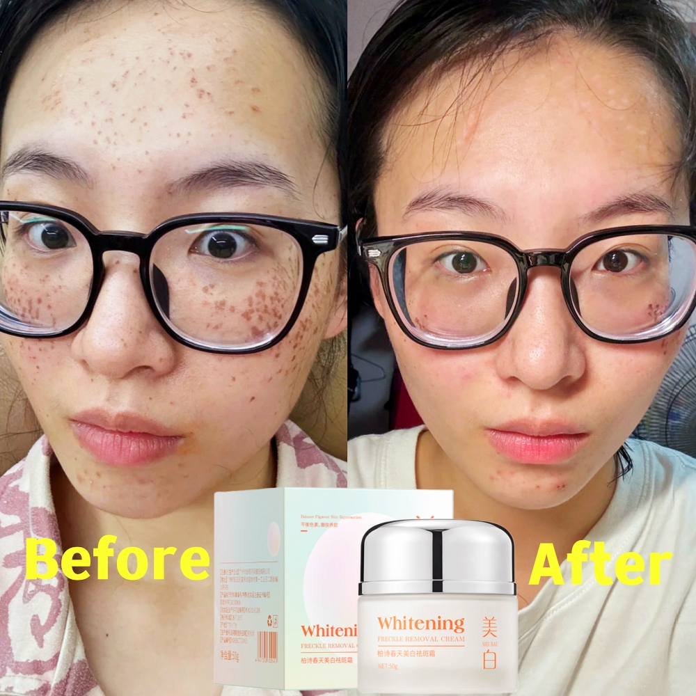 krim jeragat paling berkesan Whitening Freckle Cream pemutih muka ...