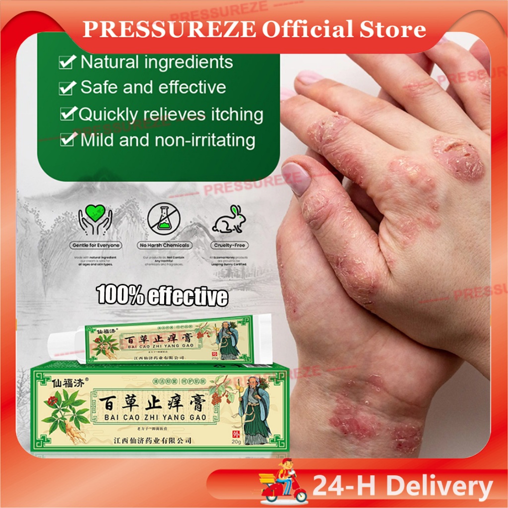 Eczema Cream Krim Gatal Kulit Herbal Antibacterial Anti Itch Relief Antifungal Cream Gatal Kulit ...