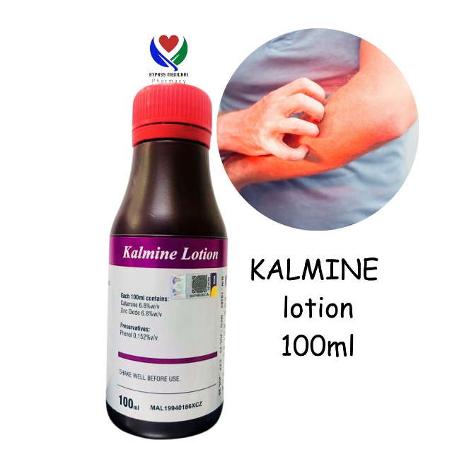 KALMINE LOTION 100ML (LOTION GATAL) | Shopee Malaysia