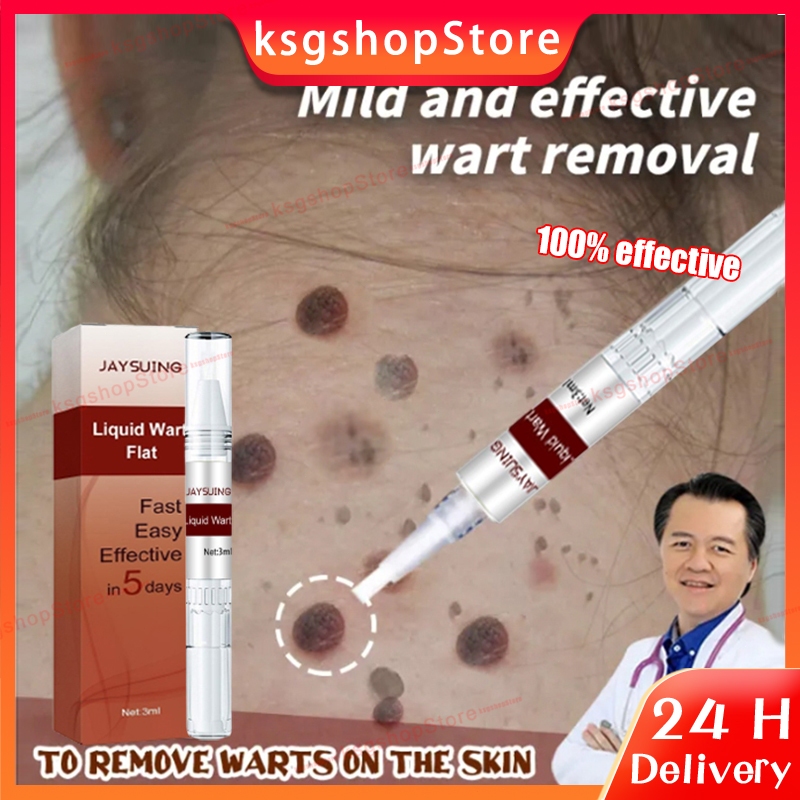 Wart Remover Pen Mole Remover Serum Pen Skin tag remover Buang tahi ...