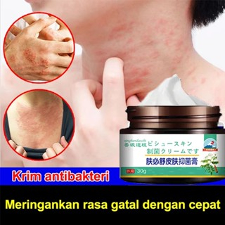 Antibacterial Cream Anti-Itch Cream Japan 30g Eczema Itchy Peeling Dermatitis ubat gatal kulit ...