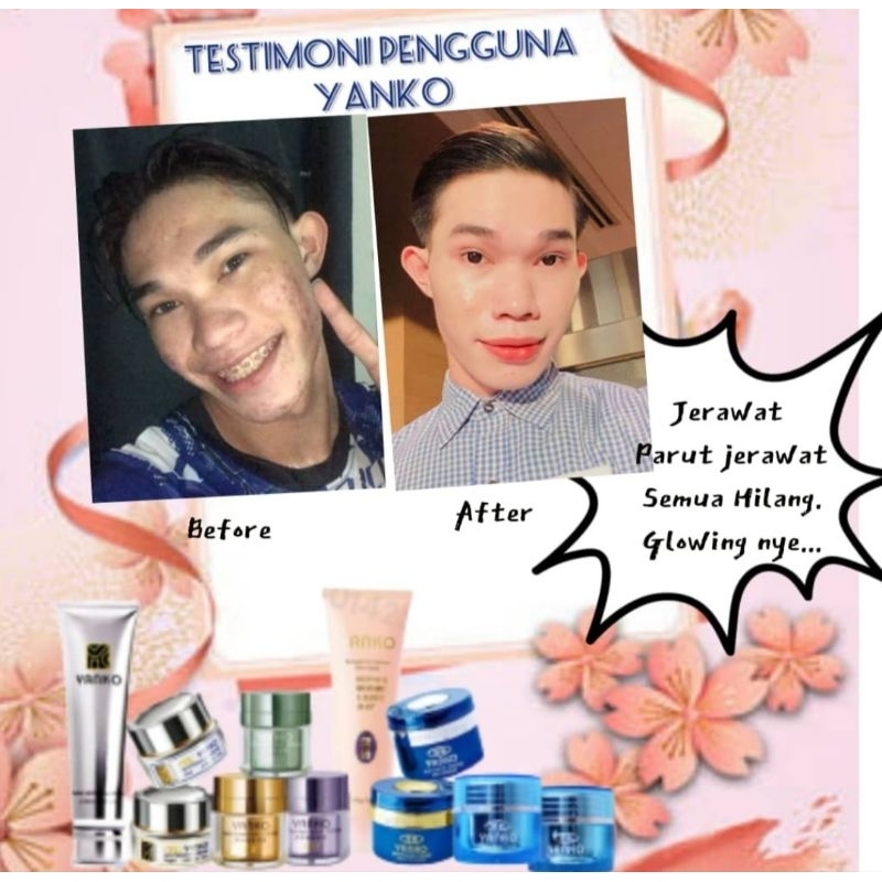 🎀 SET BASIC YANKO ORIGINAL 🎀 | Shopee Malaysia