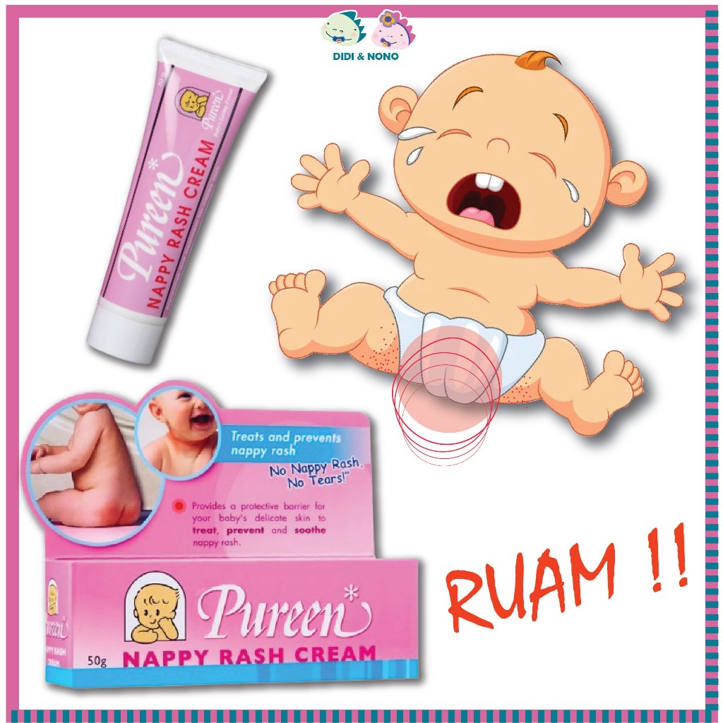 Pureen Nappy Rash Cream 50g - Krim Ruam Bayi | Shopee Malaysia