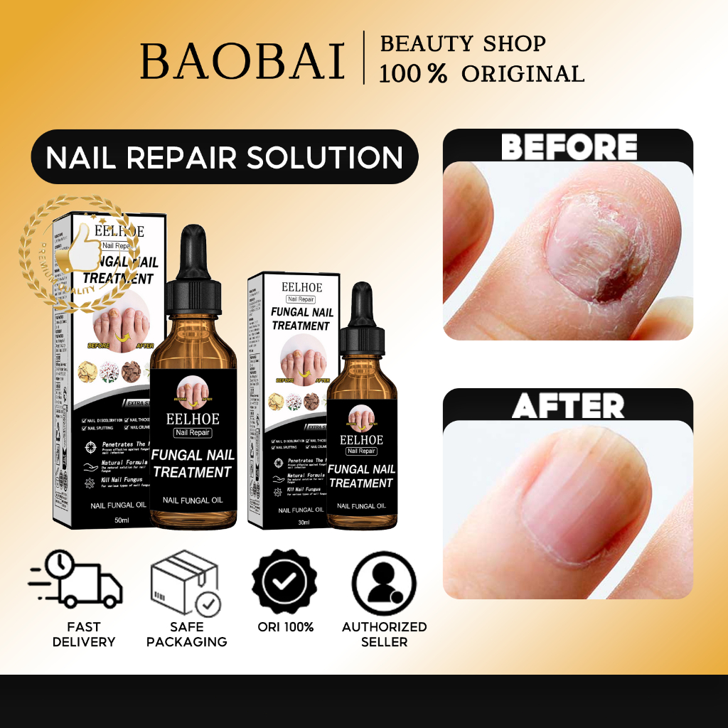 Eelhoe Nail Repair Solution Antibacerial Nail Fungus Treatment Anti ...