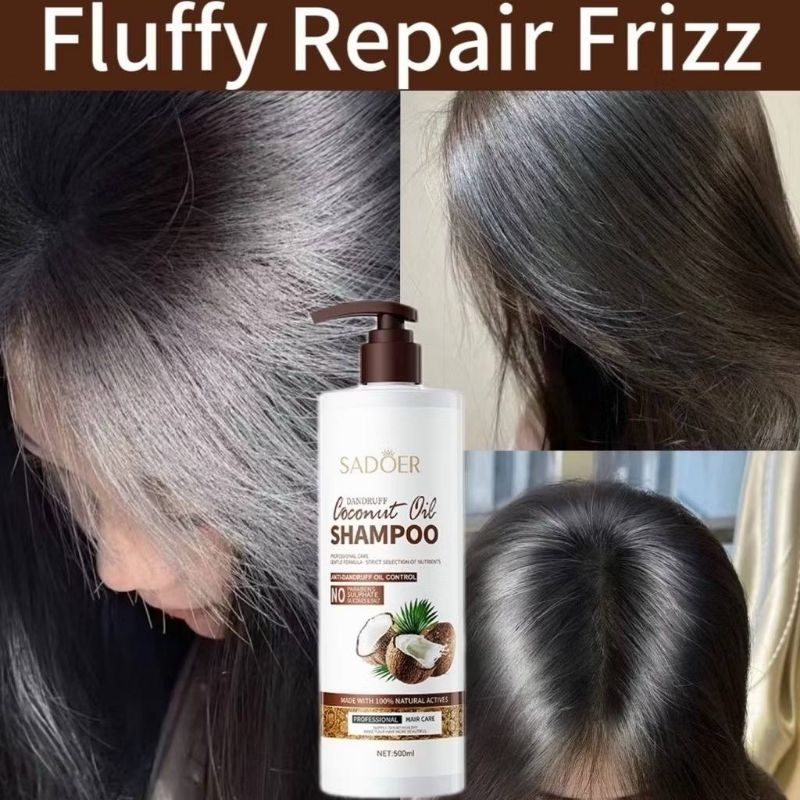SADOER SHAMPOO ANTI DANDRUFF Shampoo minyak kelapa anti kelemumur Menghilangkan kelemumur anti ...