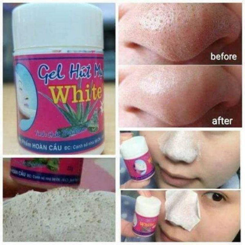 Vietnam mask Blackhead removal buka bintik hitam muka | Shopee Malaysia