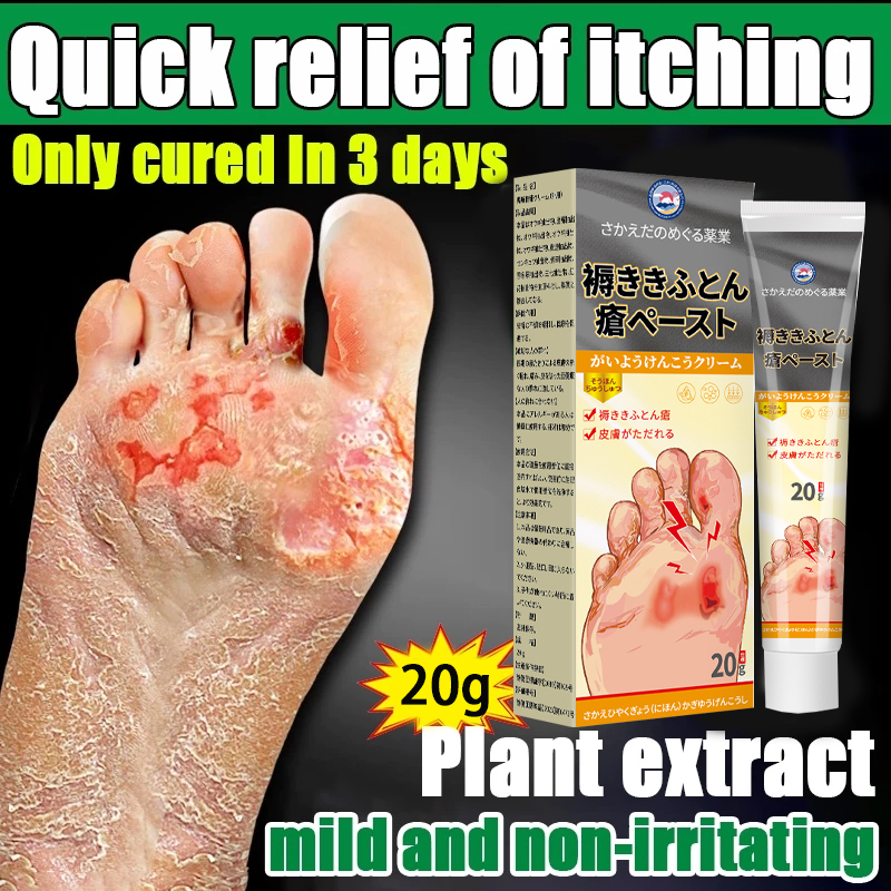 Rotten feet, cracked toes, itchy feet, anti-itch antibacterial c ...