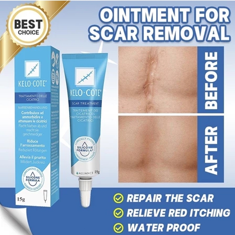 Kelo Cote Scar Gel Japan exported silicone scar gel 15g scar treatment ...