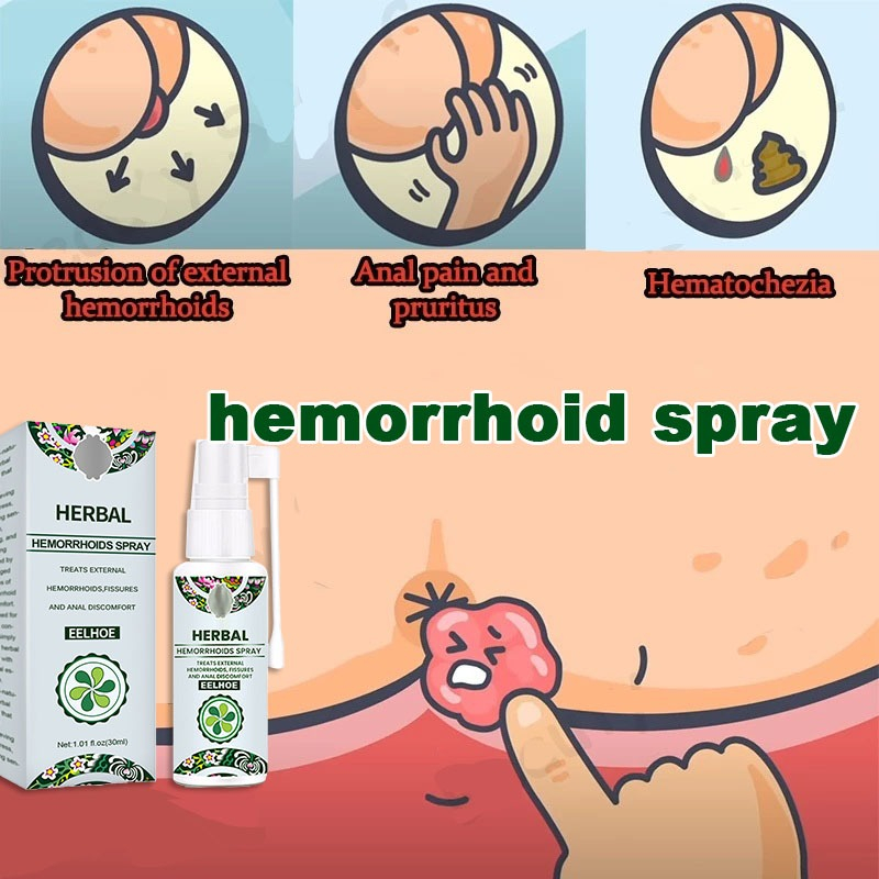 Krim Buasir Hemorrhoid Spray ubat buasir 100% paling berkesan Antibacterial Treat Internal and ...