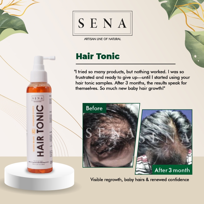 SENA Natural Hair Growth Tonic 150ml Pertumbuhan Rambut Semulajadi ...