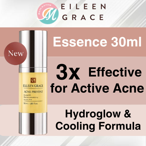 Original Official Eileen Grace Acne Care Essence 30ml Effective for Active Acne Hydroglow Acne ...