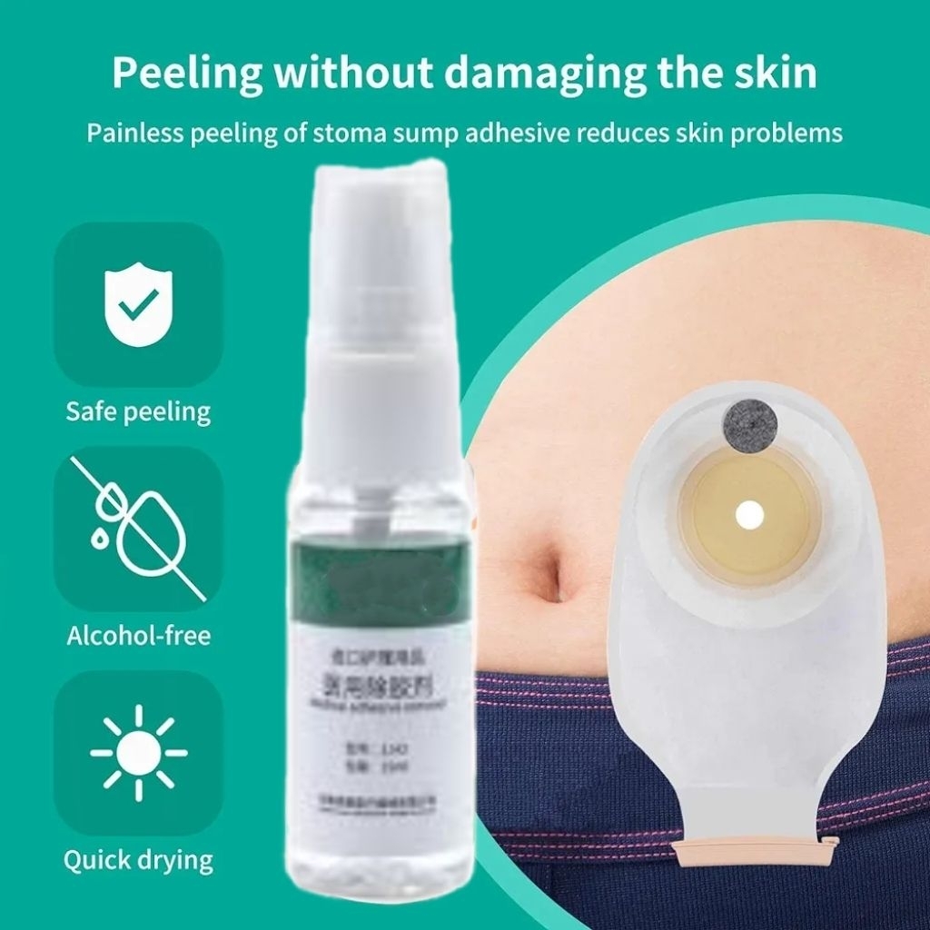  15ml Stoma Colostomy Adhesive Wipe off Spray Medical Adhesive Stoma