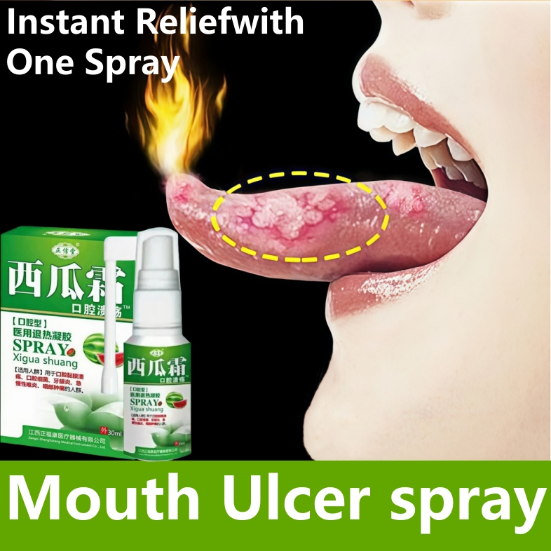 Mouth Ulcer spray Oral Ulcer Spray Ubat Sembur Ulser Mulut tooth aches ...