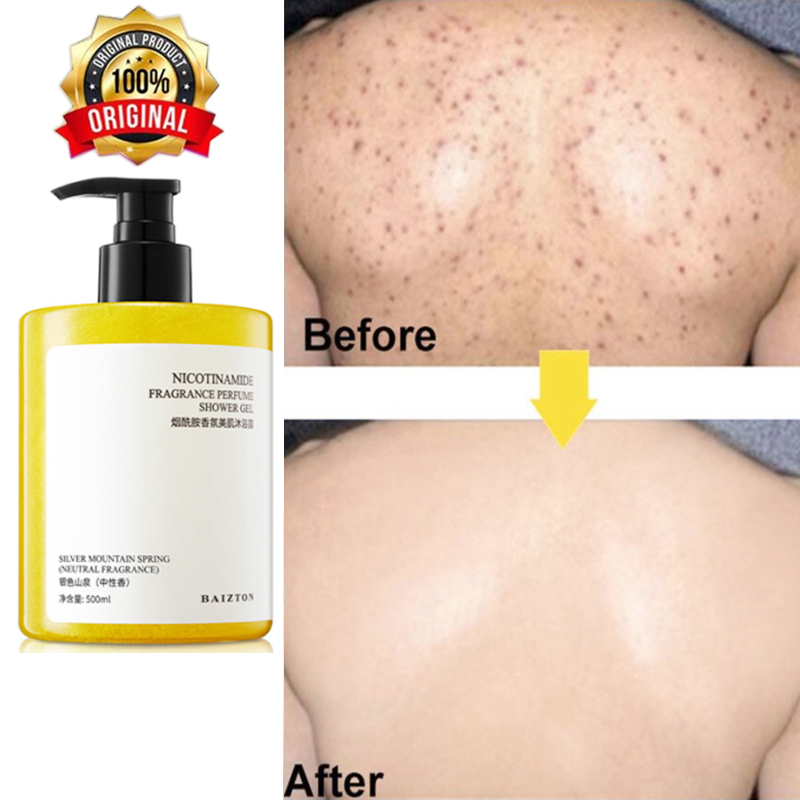Acne body wash sabun jerawat badan acne treatment body acne body wash ...