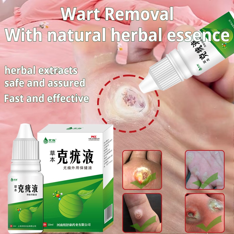 Foot Corn Warts Liquid Skin Tag Antibacterial Solution callus remover ...