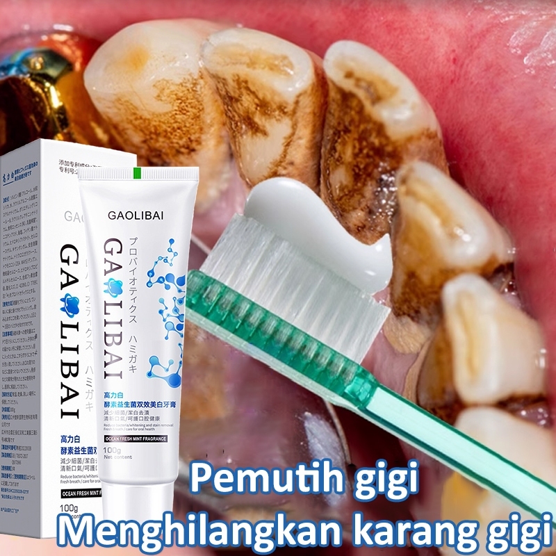 Gaolibai Pasta Gigi Penghilang Karang Gigi Pasta Gigi Pemutih Odol ...