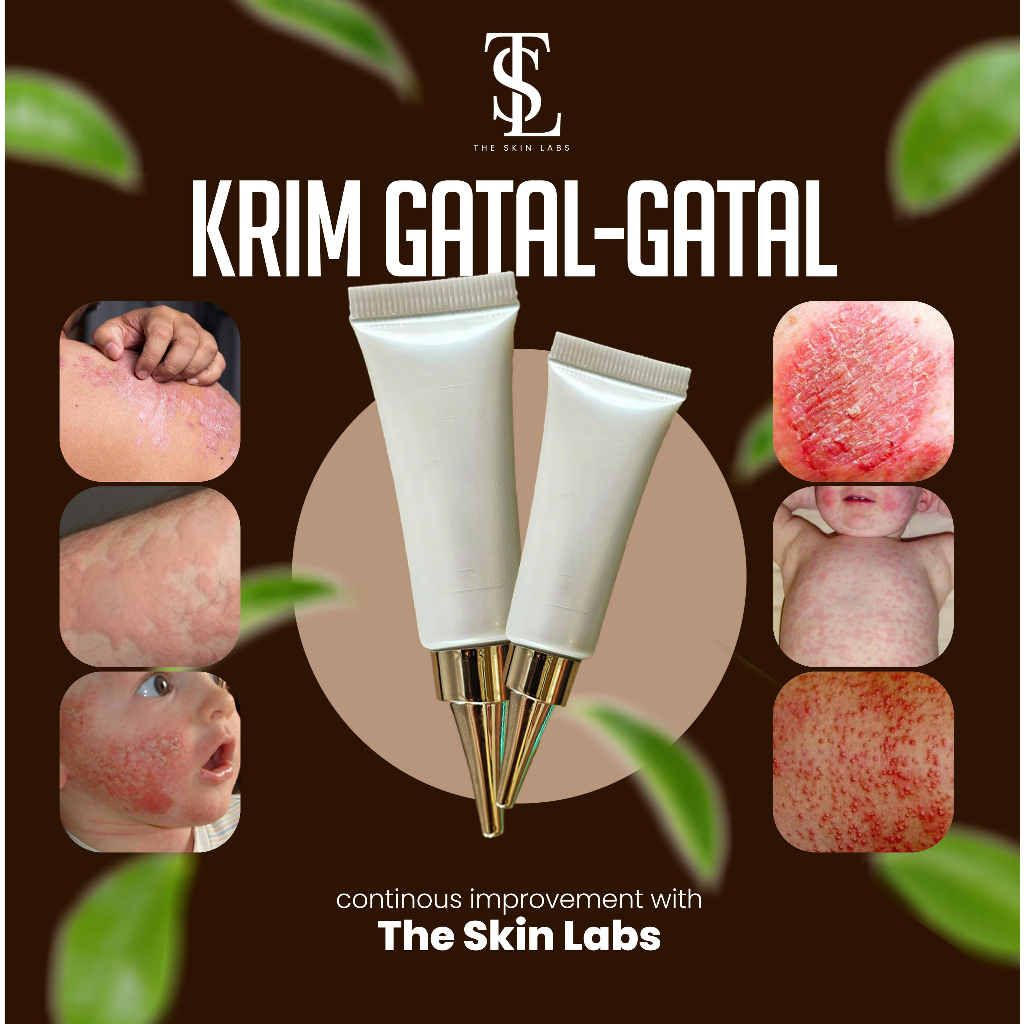 KRIM GATAL-GATAL (Gatal/Luka/Kayap/Impetigo/Kurap/Gatal) | Shopee Malaysia