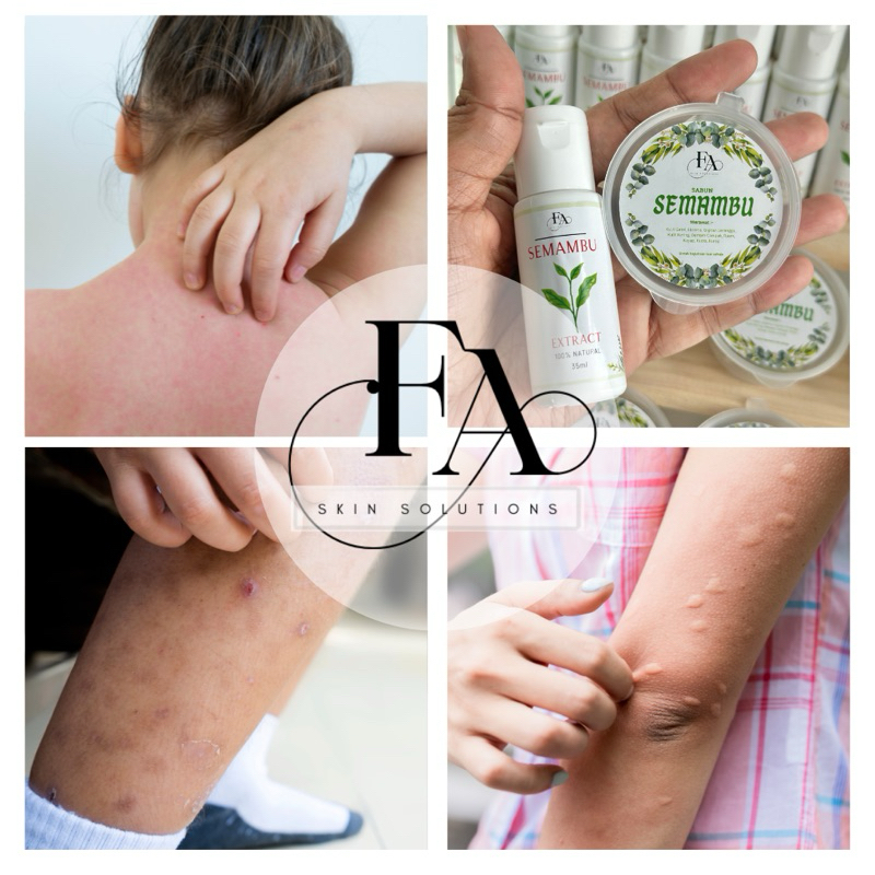 FASKIN Semambu ekstrak (Bedak Sejuk) | Shopee Malaysia