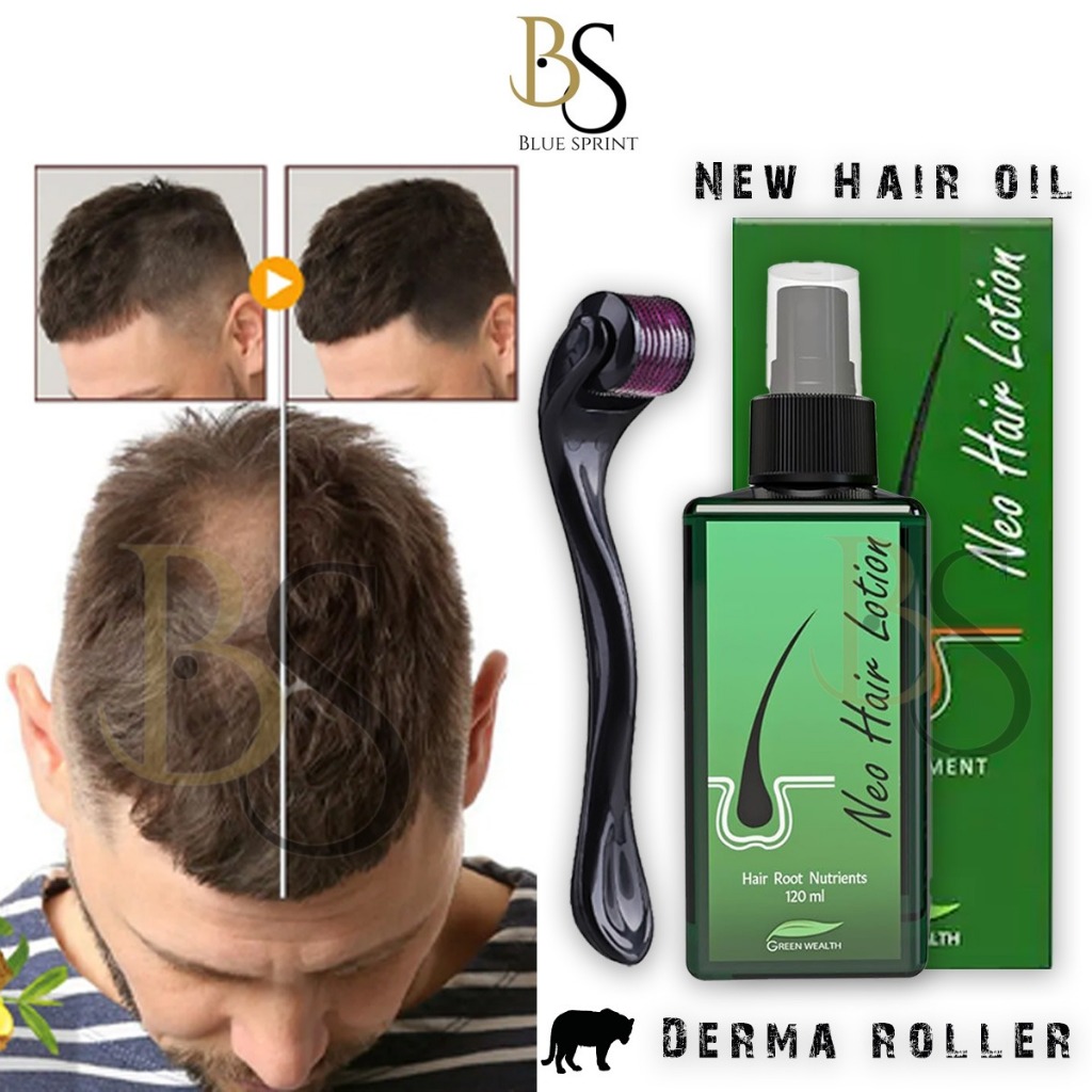 Neo Hair Lotion with FREE Derma Roller 0.3mm GIFT - Advanced Hair ...