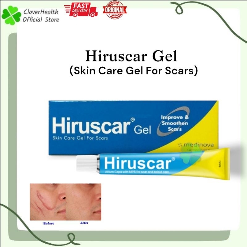 Hiruscar Gel For Scar 20g | Shopee Malaysia