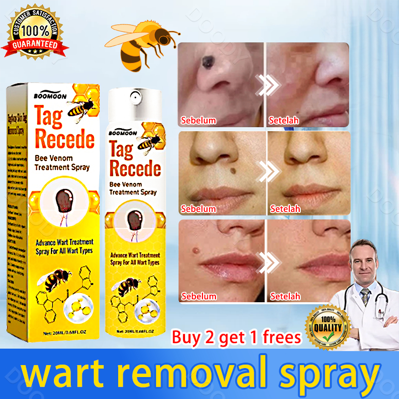 obat kutil ubat ketuat wart removal spray Skin tag remover ubat kutil ...