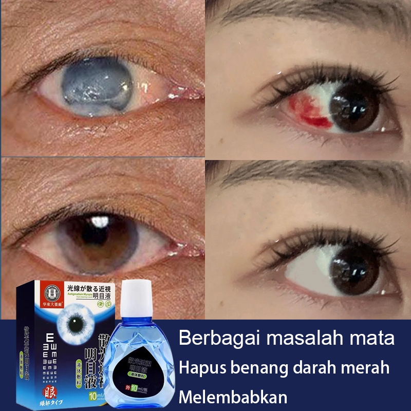 eye drop japan Obat mata katarak eye drops for dry eye mata merah ubat ...