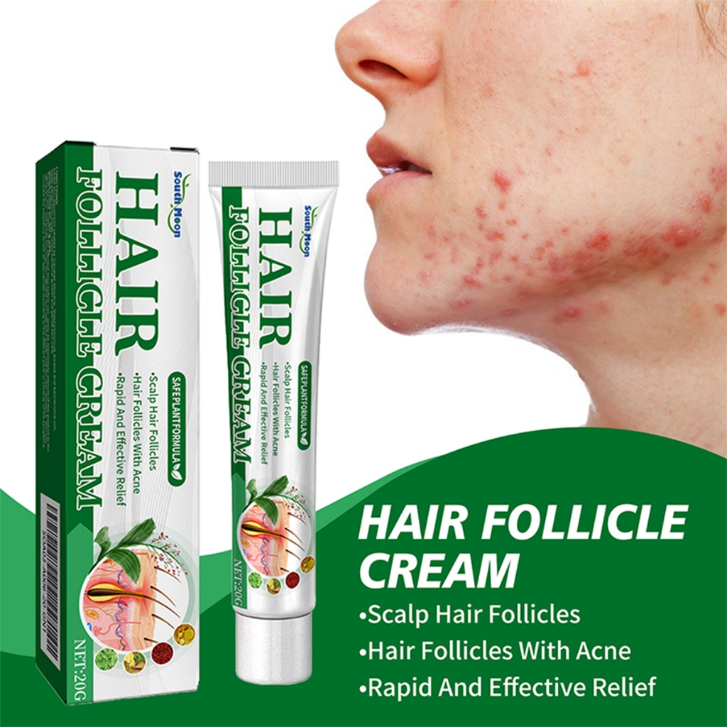 Acne Cream Skin care hair follicle cream back face head acne itching ...