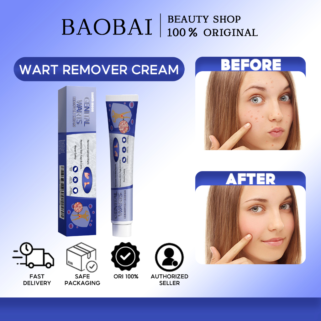 Wart Removal Cream Ubat buang kutil ketuat tahi lalat biji kolestrol ...